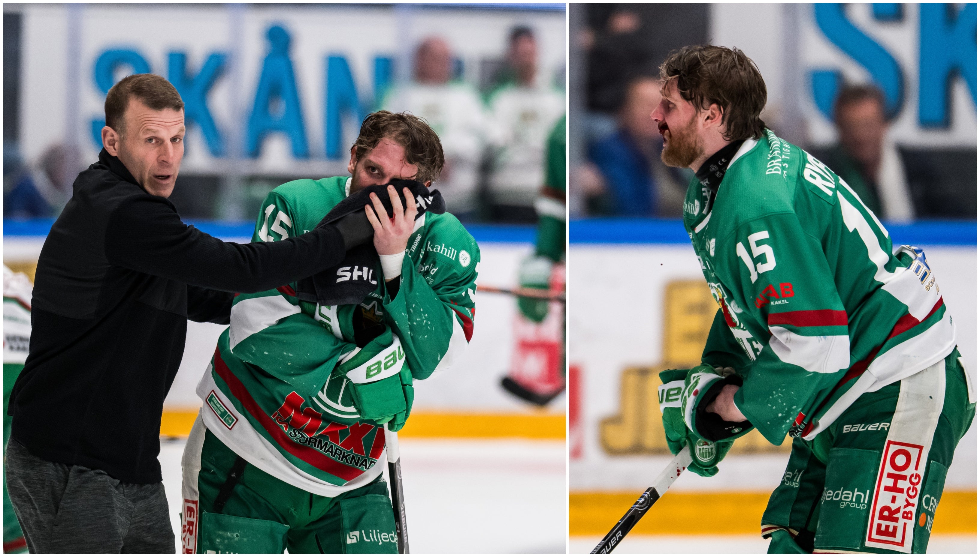 Beskedet Kring Stjärnan Efter Otäcka Bilderna Hockeynews