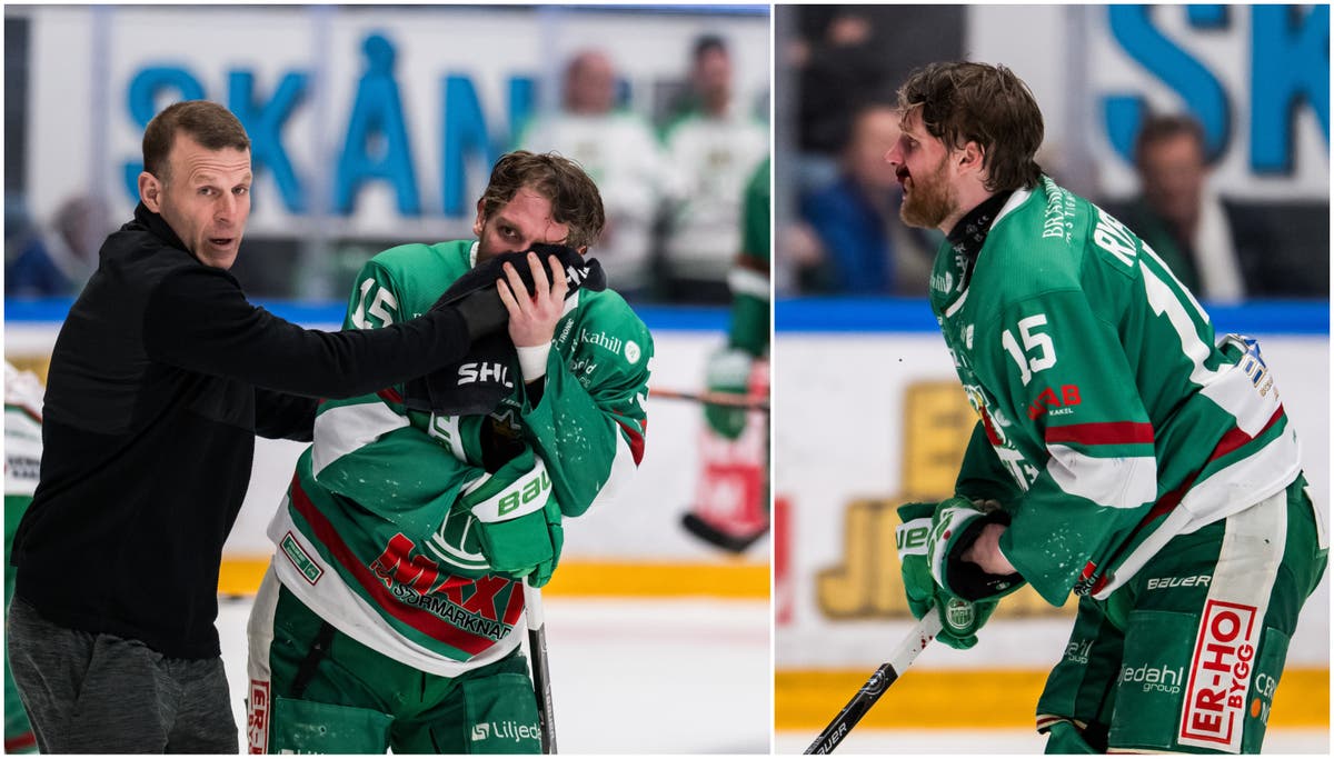 Beskedet kring stjärnan – efter otäcka bilderna